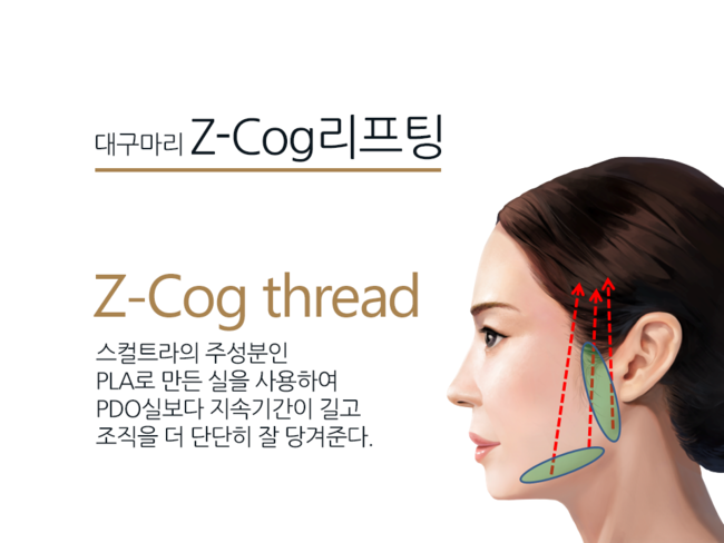 피부탄력개선 슈링크리프팅피부처짐개선 실리프팅이중턱개선 대구마리의원 V라인주사슈링크리프팅 네이버 블로그