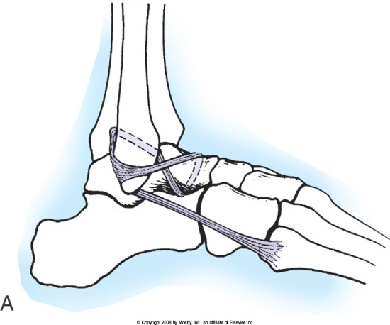 [Text] 만성 족관절 불안정증 : Chronic Ankle Instability by SungHun.Kim. : 네이버 블로그