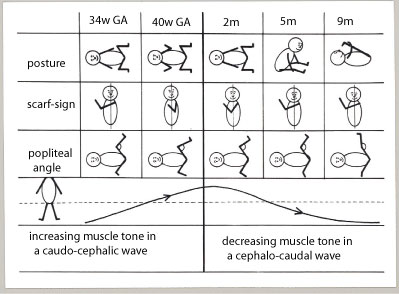 Neurologic examination 중 Tone 평가. : 네이버 블로그