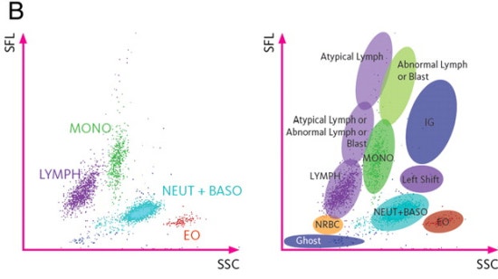 자동혈액분석기 Sysmex XN-Series : 네이버 블로그