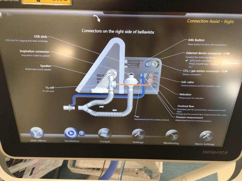 Ventilator, 인공호흡기, Bellavista에 대해서. : 네이버 블로그
